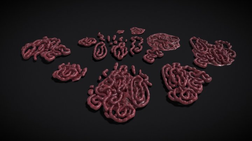 Intestines Piles