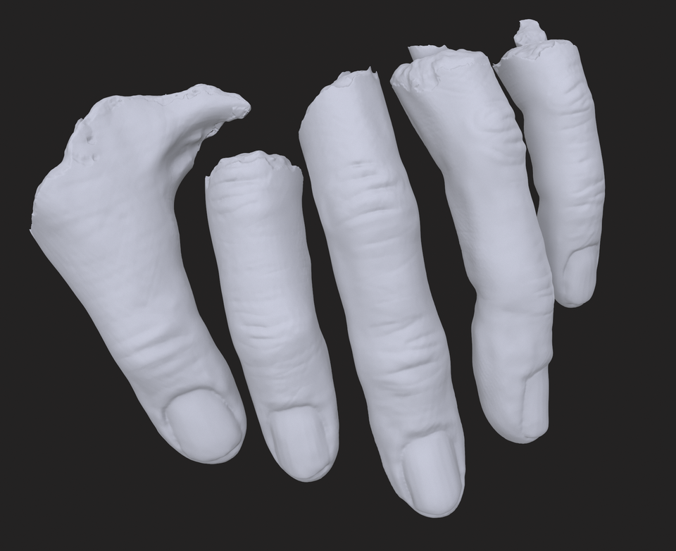 Severed Fingers