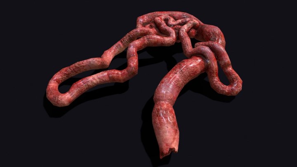 Intestines Piles