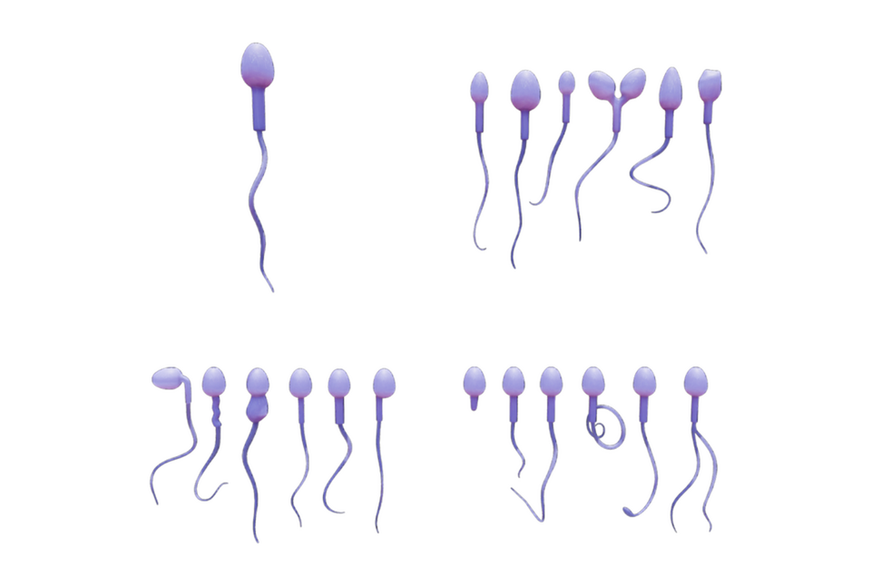 Sperm Morphology: Normal and Abnormal