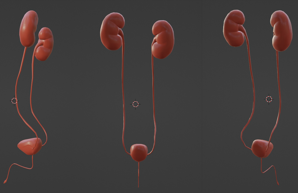 3D Model of Urinary System