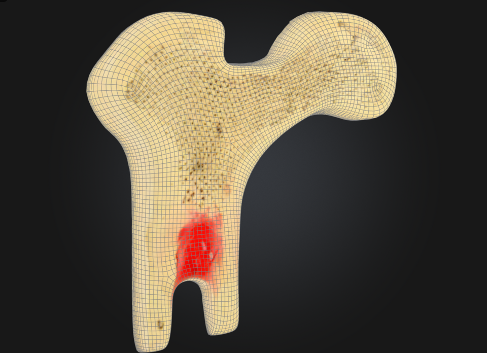 Human Bone Microstructure with Long Bone Osteon