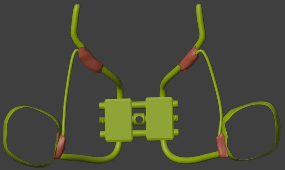3D Model of Rapid Palatal Expander