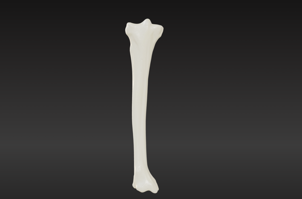 3D Model of Tibia Bone